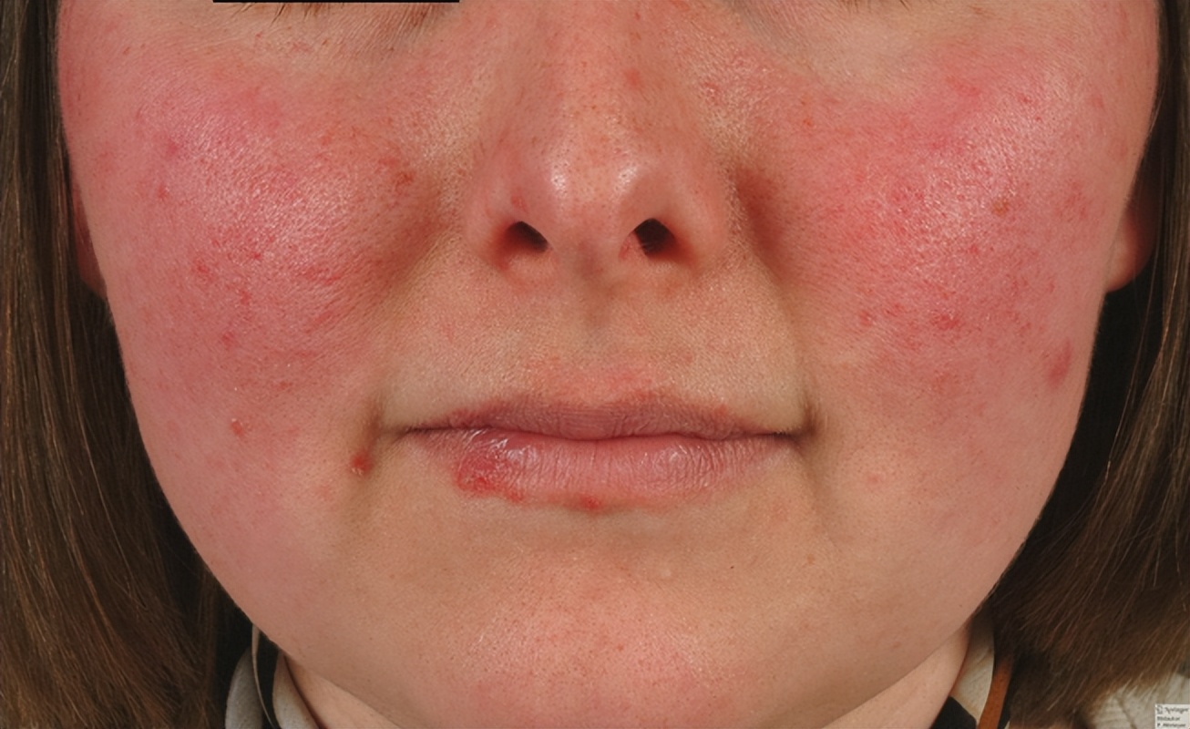 Is AIDS that scary? - iNEWS