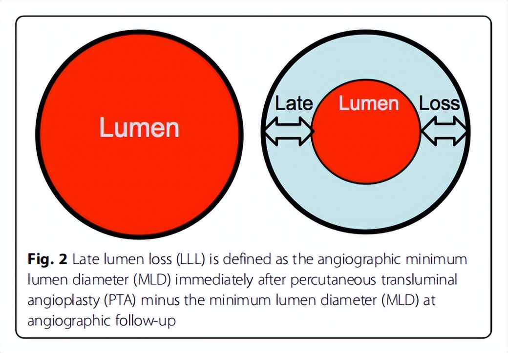 Intervention Literature Issue 7 (Peripheral Interventions) - DEB vs ...