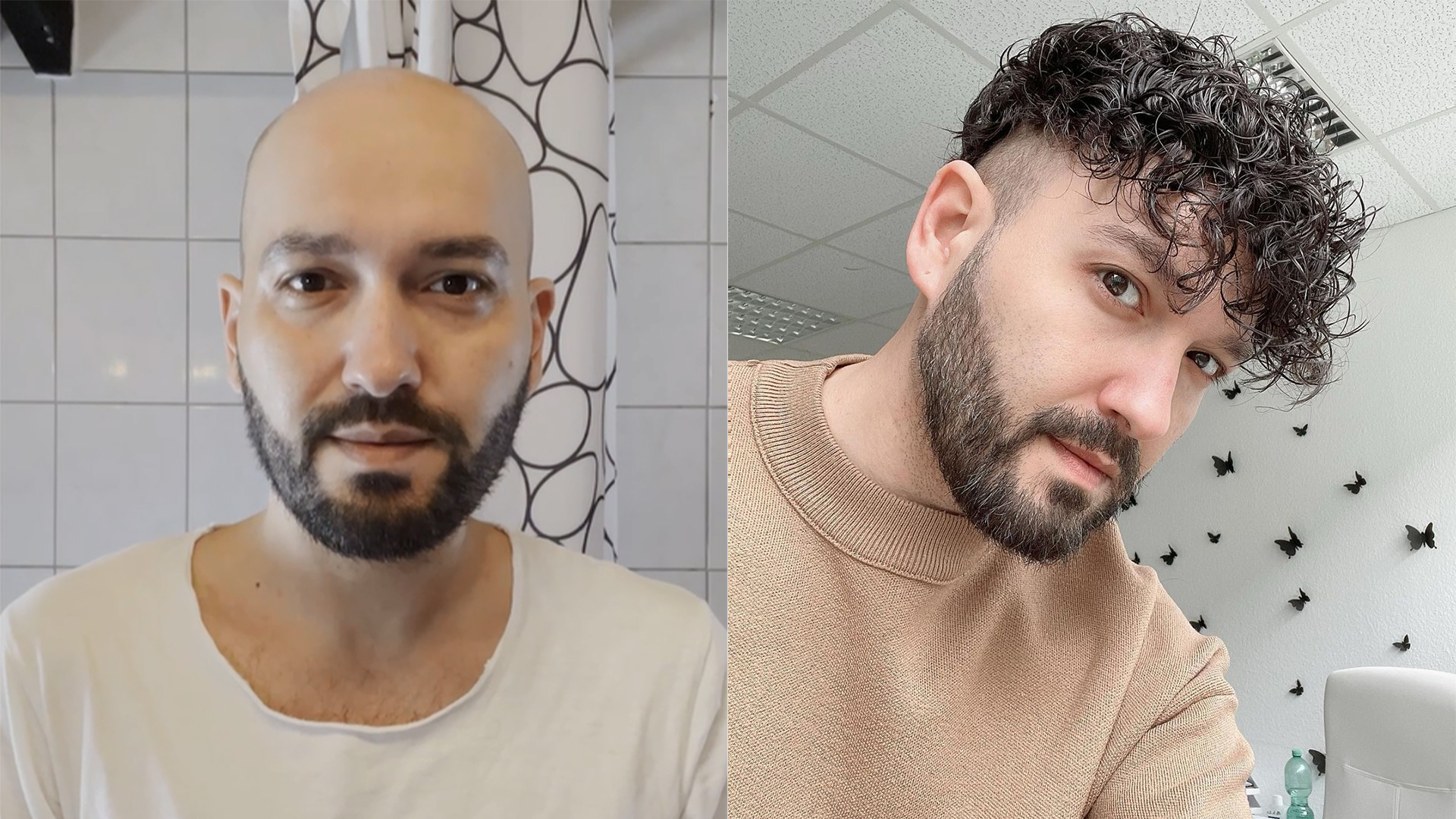 Baldness is ugly, but why do many people prefer to be bald rather than ...