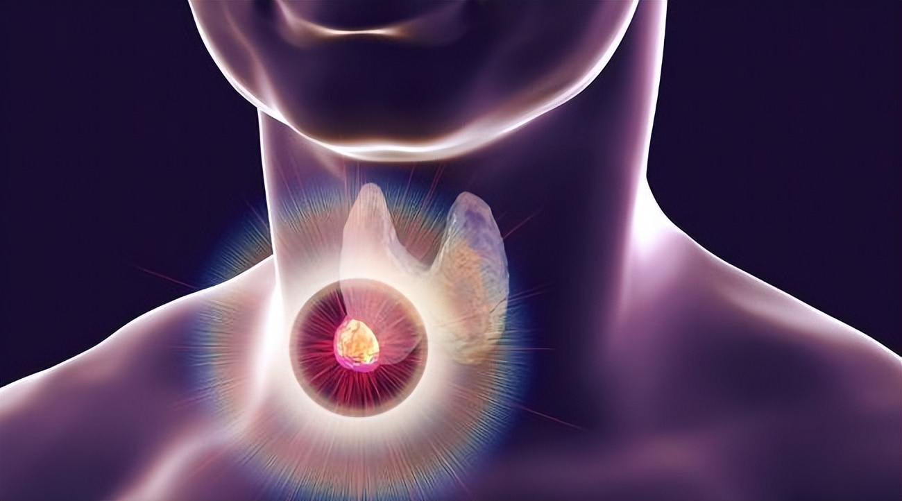 Controversy in the tumor community: 3 types of cancer are not fatal, or ...