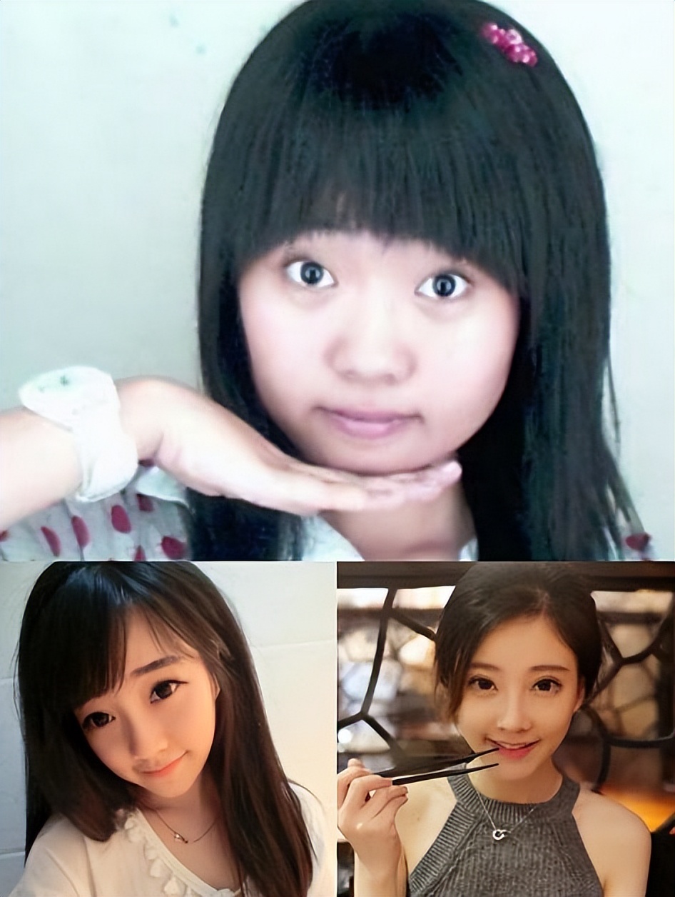 Is Feng Timo cold?After plastic surgery, the face gap is a bit big ...