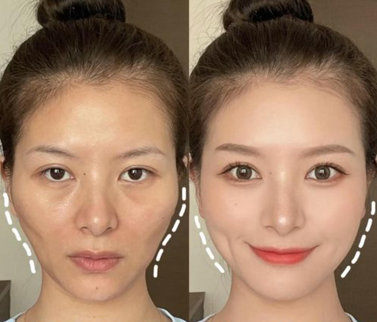 What to do if these 3 aging phenomena appear on the face: sunken ...