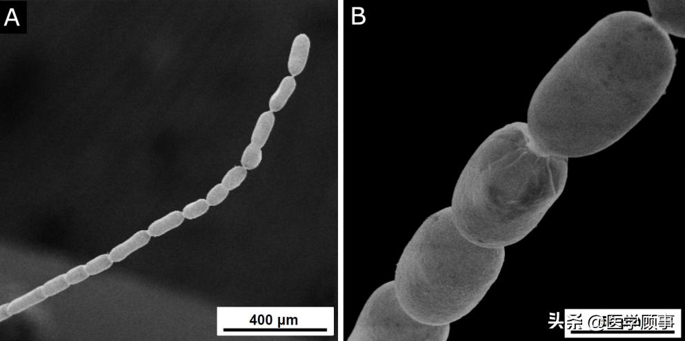 The world's largest giant bacteria with a body length of 2 cm has ...