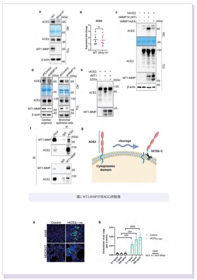 MT1-MMP mediates ACE2 shedding to control SARS-CoV-2 infection - iMedia