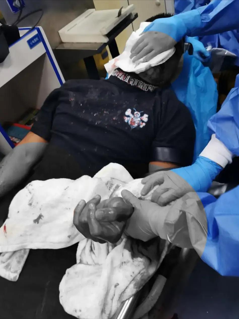 Huang Junfeng: Because the character was accidentally hacked and ...