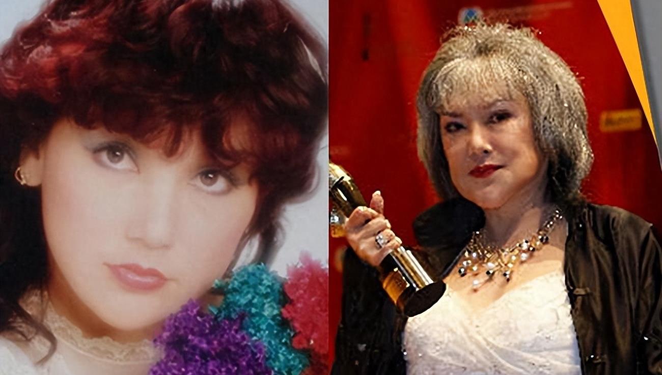 The actress who is addicted to plastic surgery has transformed herself ...