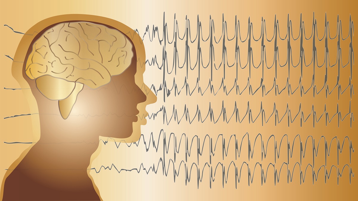 If you have a seizure, don't panic, master the 5-step first aid method ...