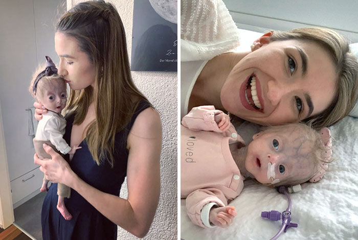 20 Humans With Rare Genes, There Are So Many Unique Humans In The World ...