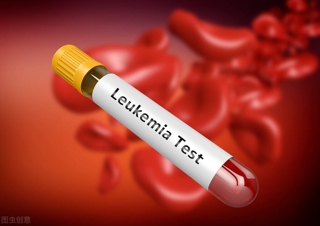 Several manifestations of leukemia - iNEWS