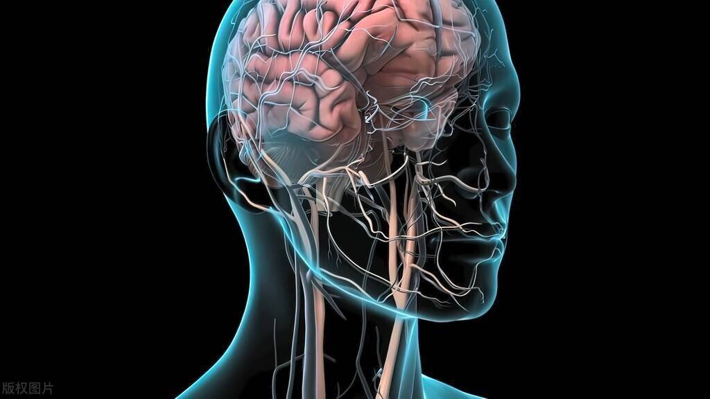 What are the manifestations of cerebral hemorrhage - iMedia