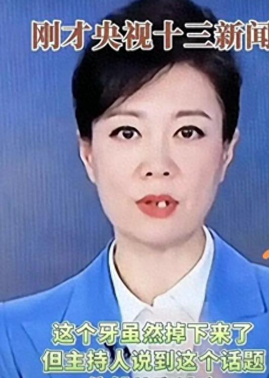 CCTV host Wen Jing was suspected of losing her front teeth during the ...