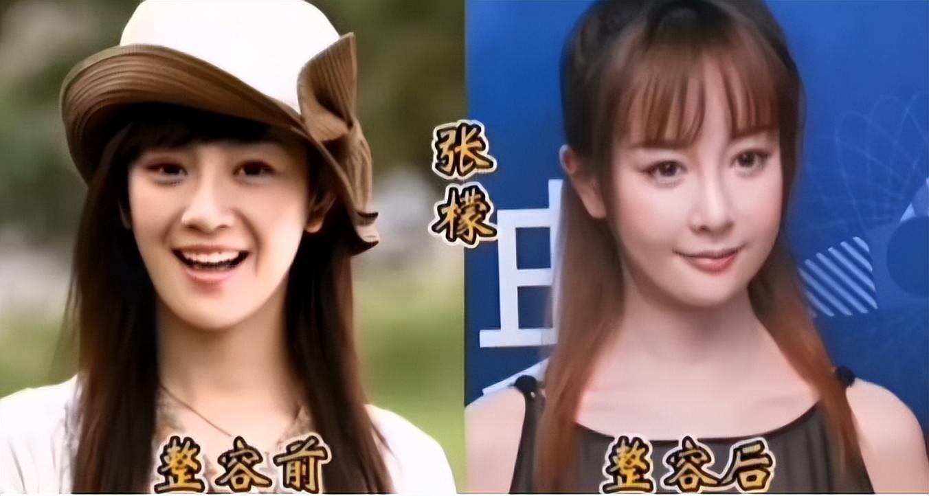 Comparing actresses before and after plastic surgery, Li Bingbing and ...