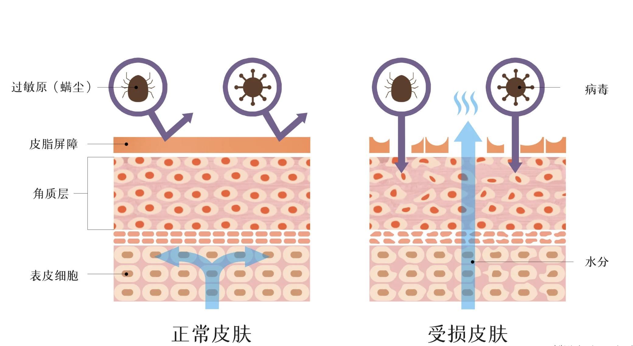 4 manifestations of damaged skin barrier!Let's see if you got hit? - iNEWS
