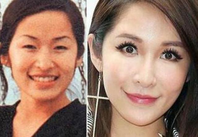 The 6 most successful plastic surgery female stars, the surgery is very ...