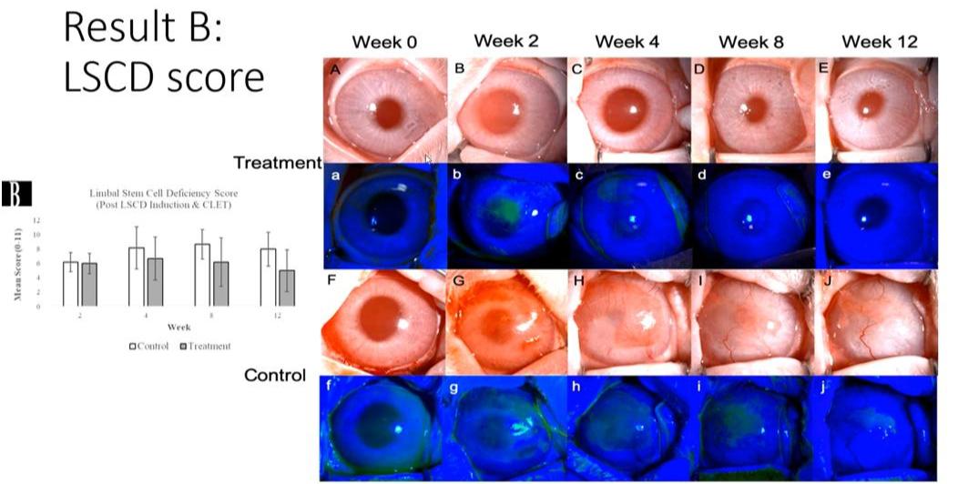 A New Approach to Treat Corneal Blindness Caused by Limbal Stem Cell ...