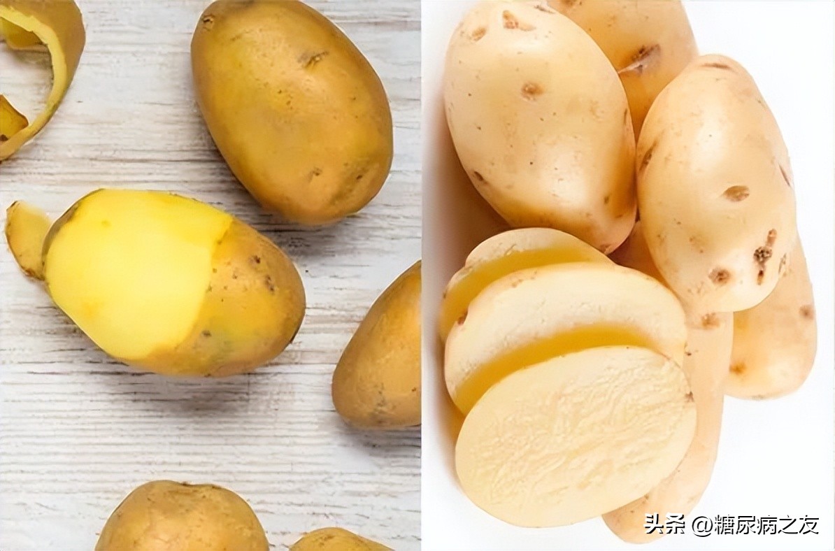 Yellow potatoes, white potatoes: Which has the least effect on blood ...