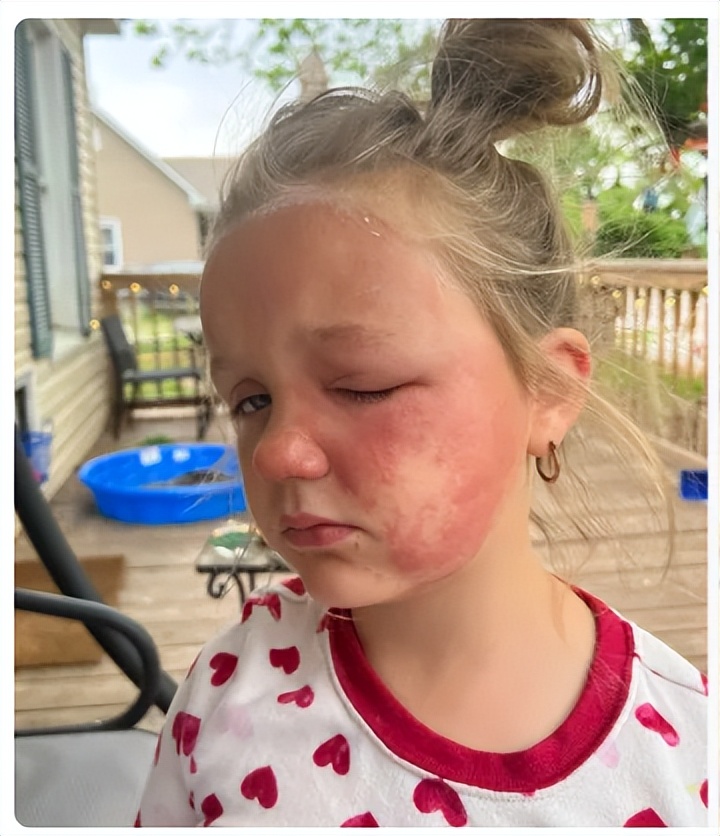 Beware of this common plant in Australia's backyard, a six-year-old ...