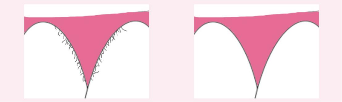 Why do people have pubic hair? - iNEWS