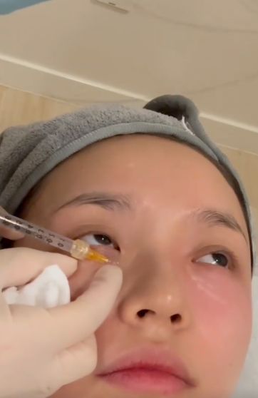 So true! Lin Yunshao's process of applying hydro-acupuncture, the ...