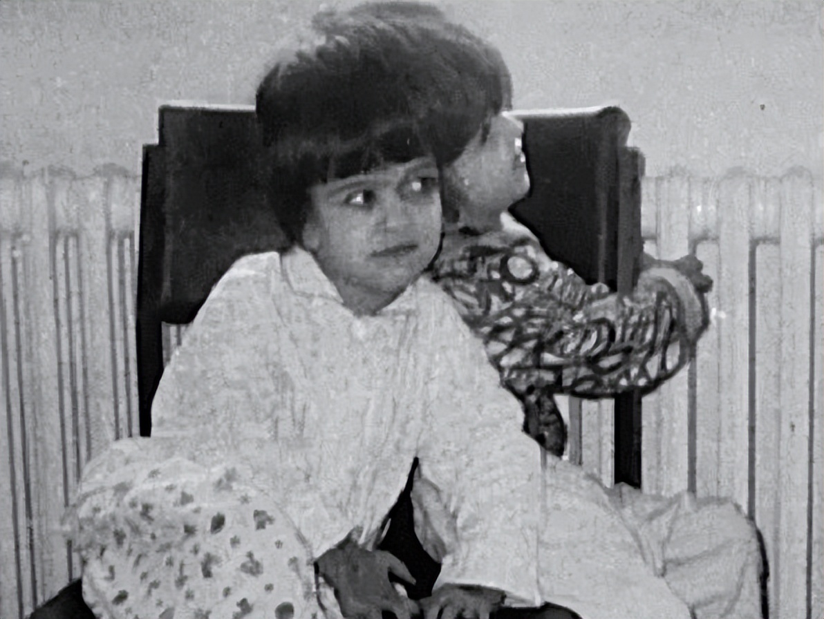 Conjoined twins have 22 children? Brothers separated by surgery ...