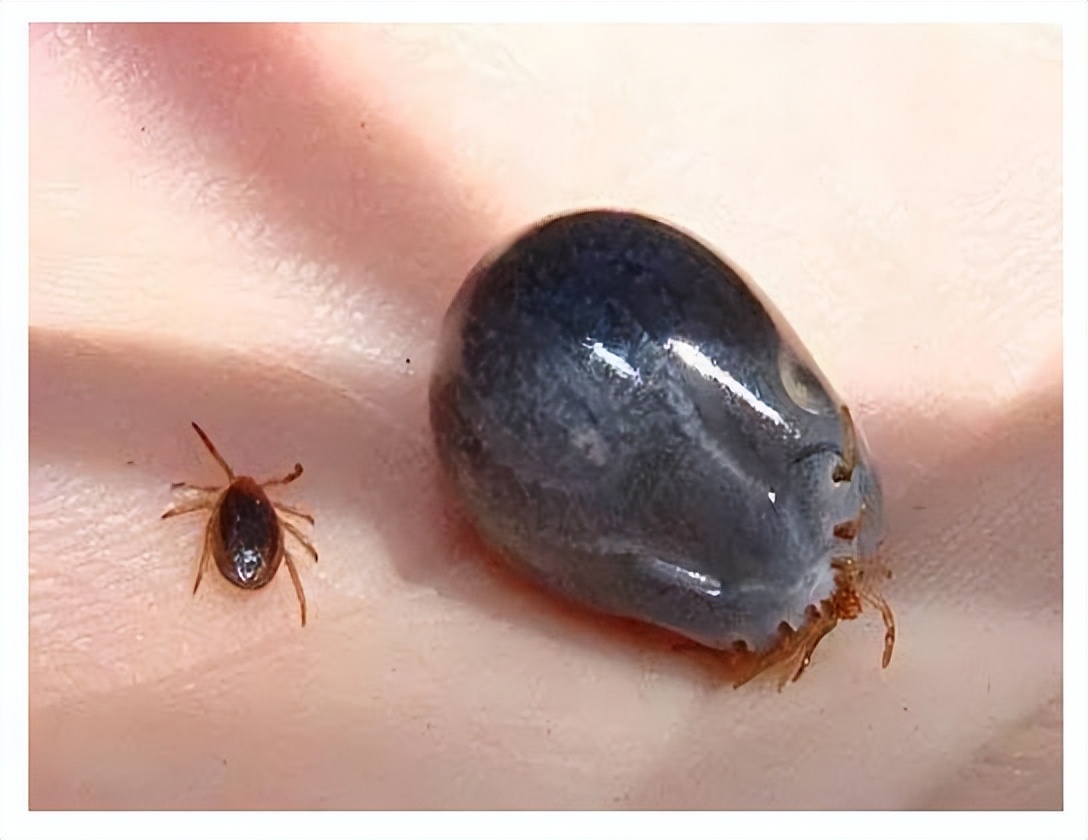 Blood-sucking "bugs" around you: bedbugs, ticks, fleas, lice - iNEWS