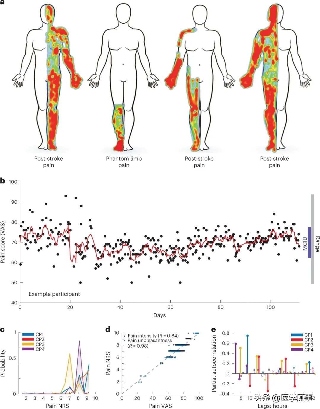 Nat Neurosci︱First use of intracranial neural biomarkers to predict ...