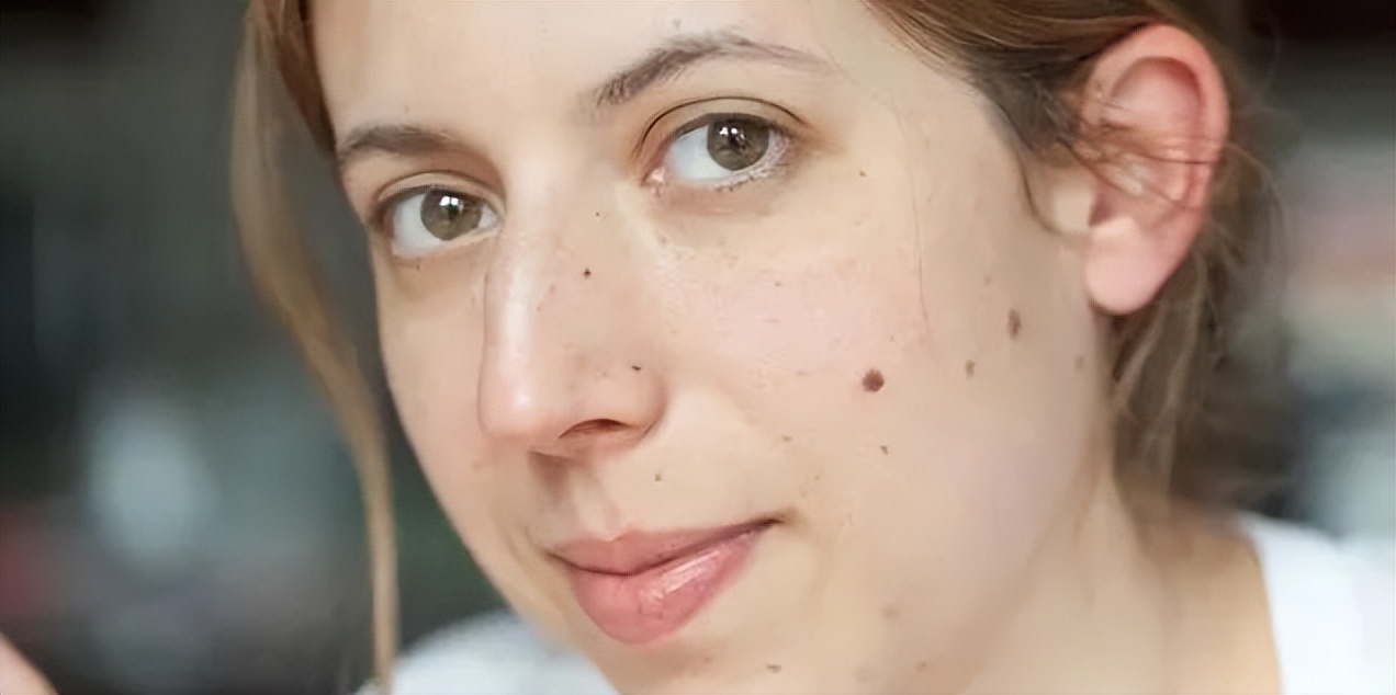 The body has cancer, the skin prophet, 4 manifestations of the skin ...