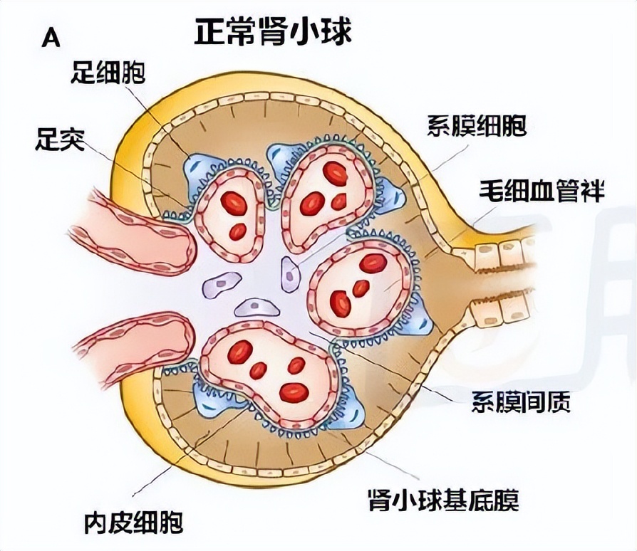 What are the pathological types of kidney disease and what are their ...