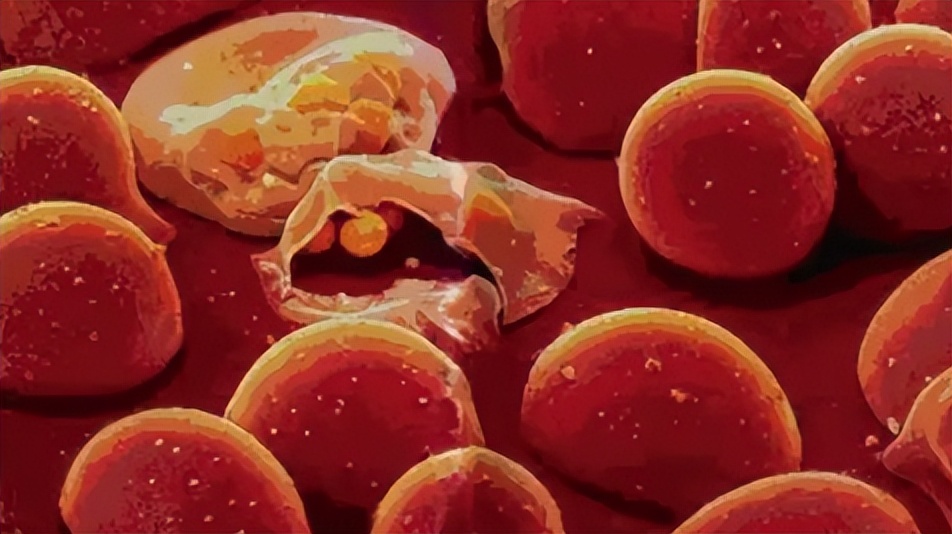 NINJ1 protein aggregates to form fiber bundles that promote plasma ...