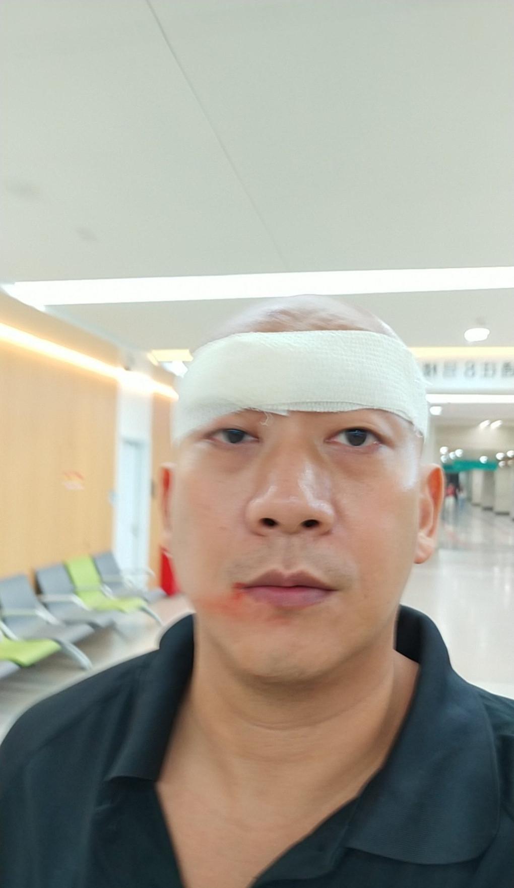 Hong Kong actor filming Zhang Yimou's new drama had an accident! The ...