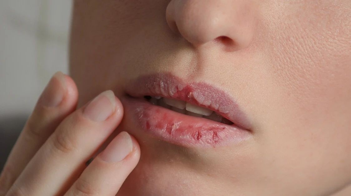 In autumn and winter, the lips are plucked and peeled. How to apply ...