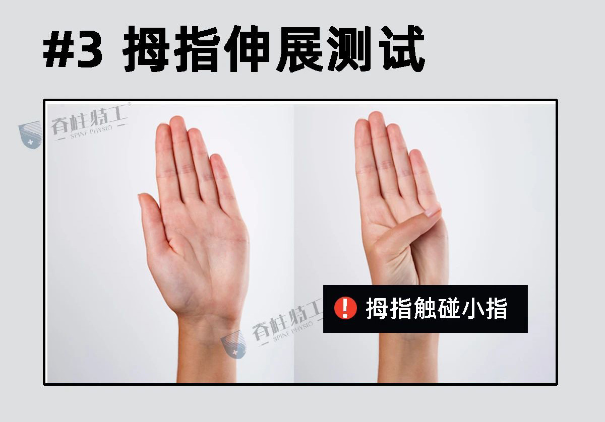 Can you pass the 6 hand health tests? Can it reveal hand problems? - iMedia