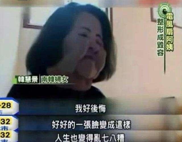 Korean female singer Han Huijing: 28-year-old plastic surgery ...