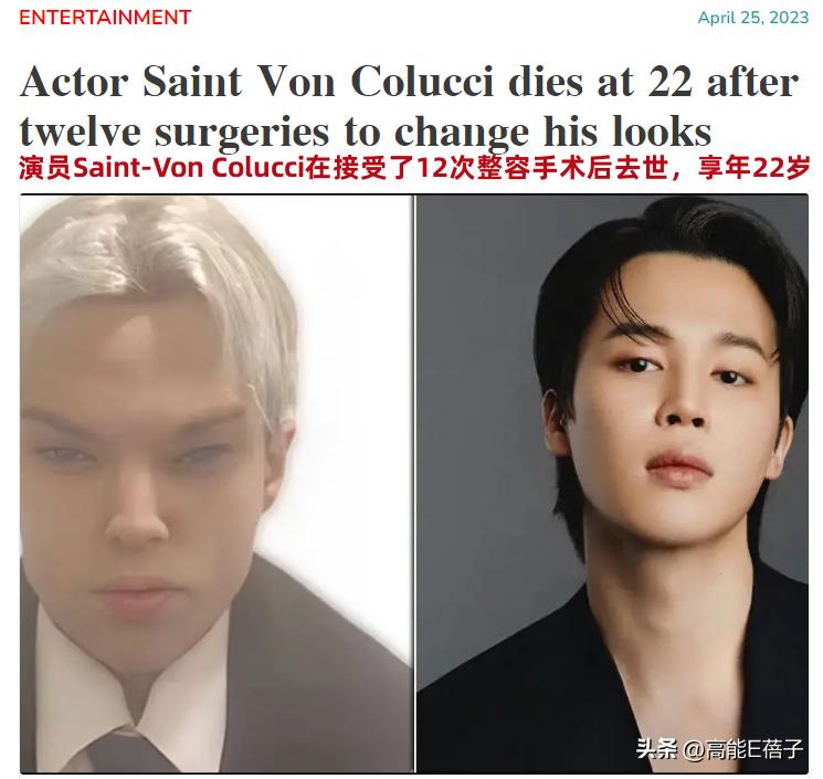 The 22-year-old Canadian actor spent 1.56 million to change his face ...