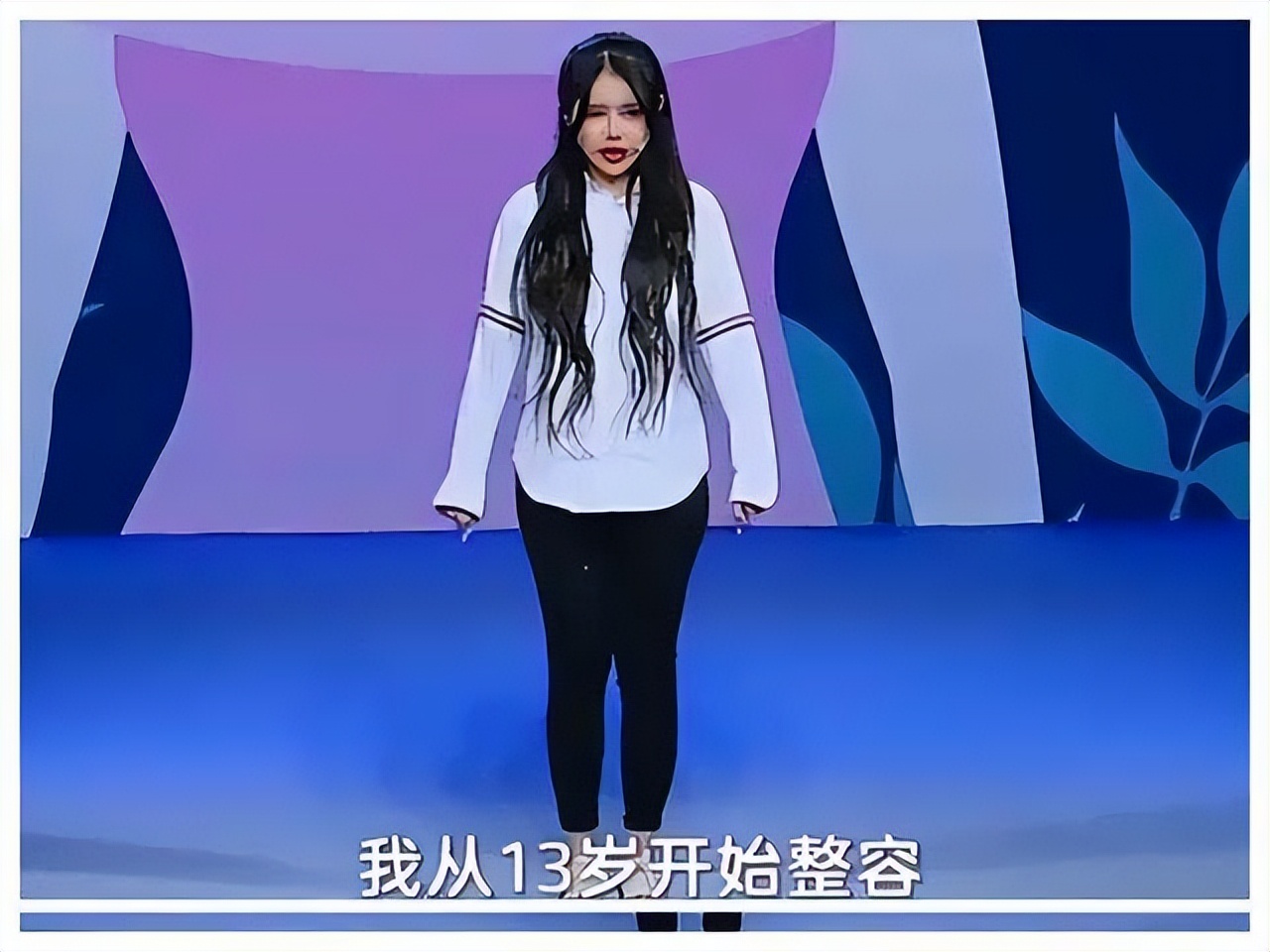 Zhou Chuna, who took plastic surgery as soon as possible, is now so ...