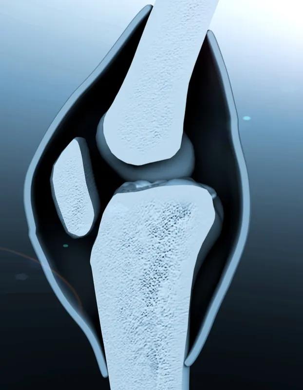 Protect your knees and strengthen your quads - iNEWS