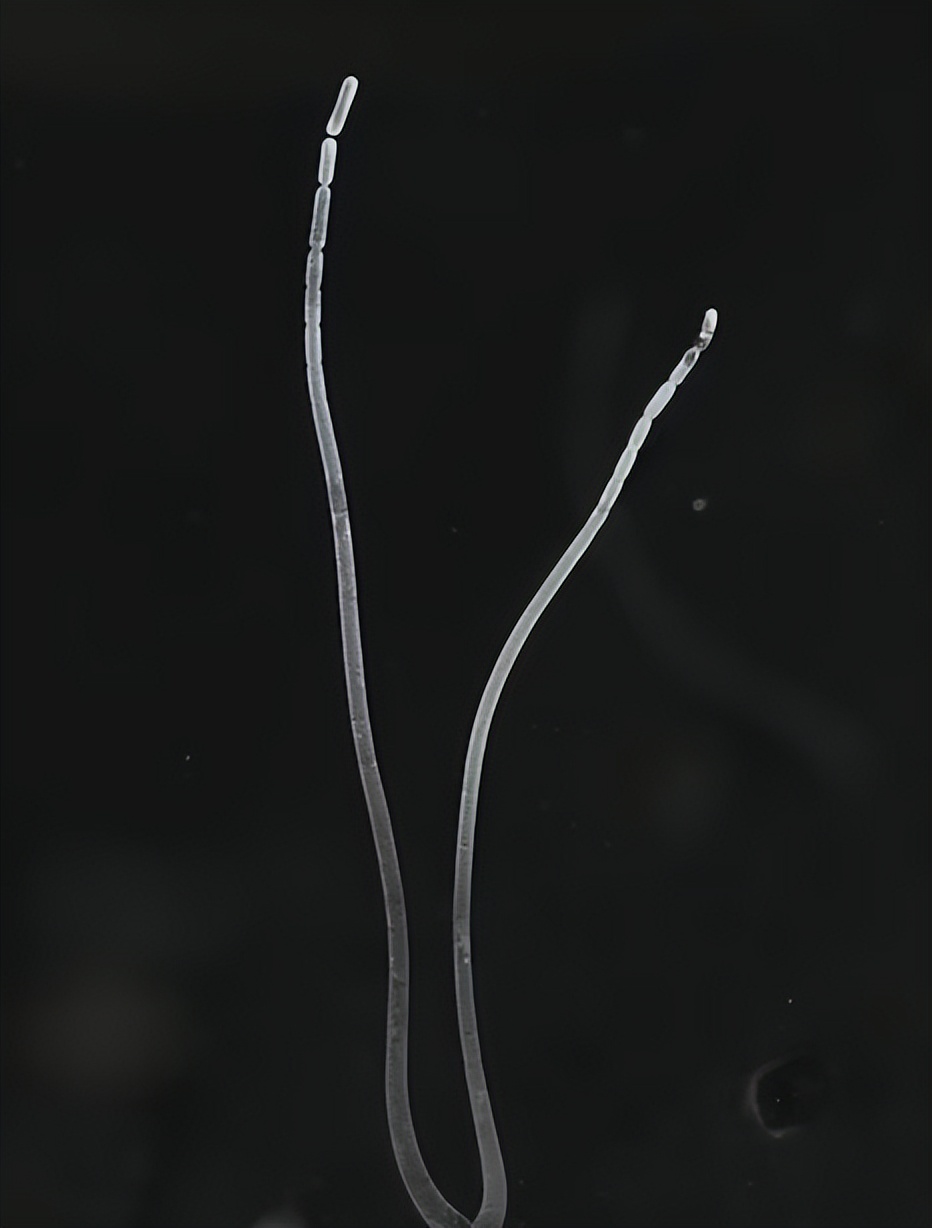 French scientists discover the world's largest bacteria!A single ...