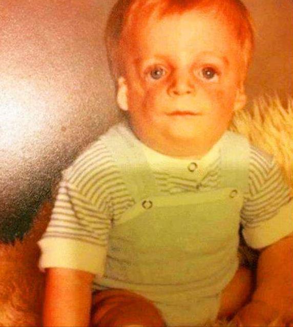 The British man has a deformed face. He married a beautiful wife by ...