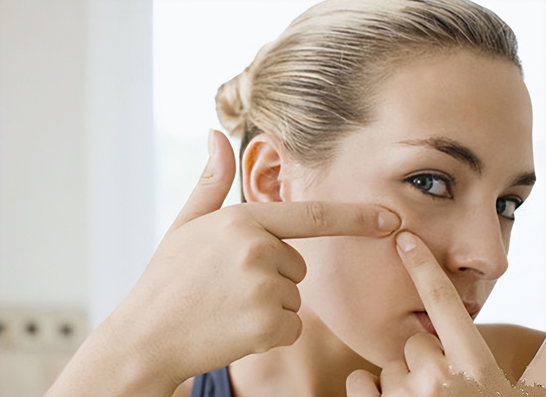 The right way to pop a pimple - iNEWS