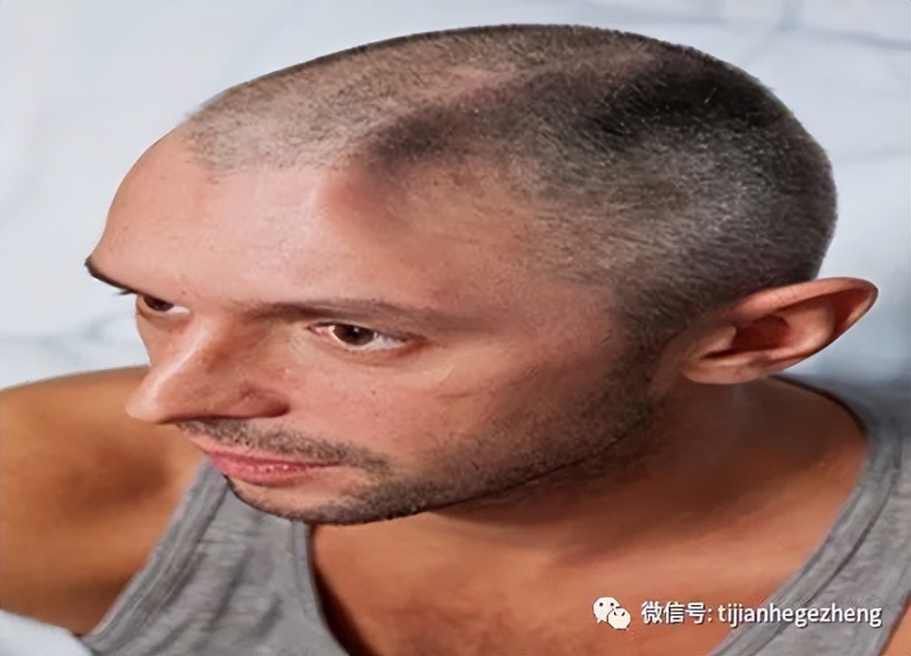 Common Head Deformities in Recruitment Physical Examination - iNEWS