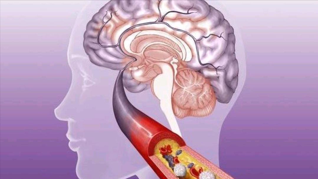Can eating pig brain nourish the brain?Doctor: It doesn't supplement ...