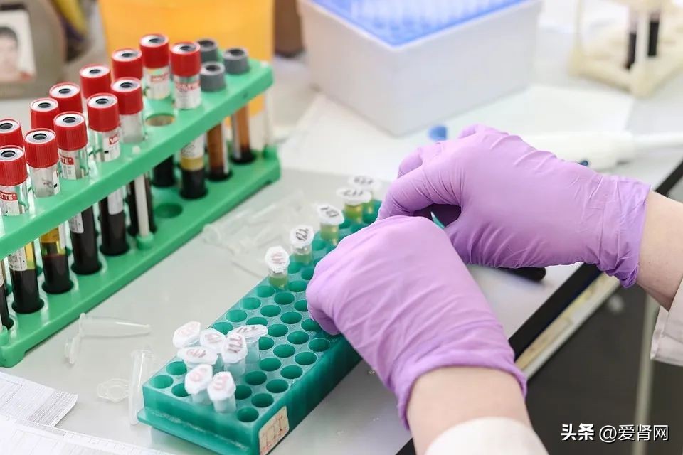 What are the items to know about nephrology laboratory tests? - iNEWS