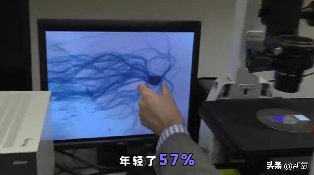 Harvard's latest research: reverse aging! ! The side effect is to lose ...