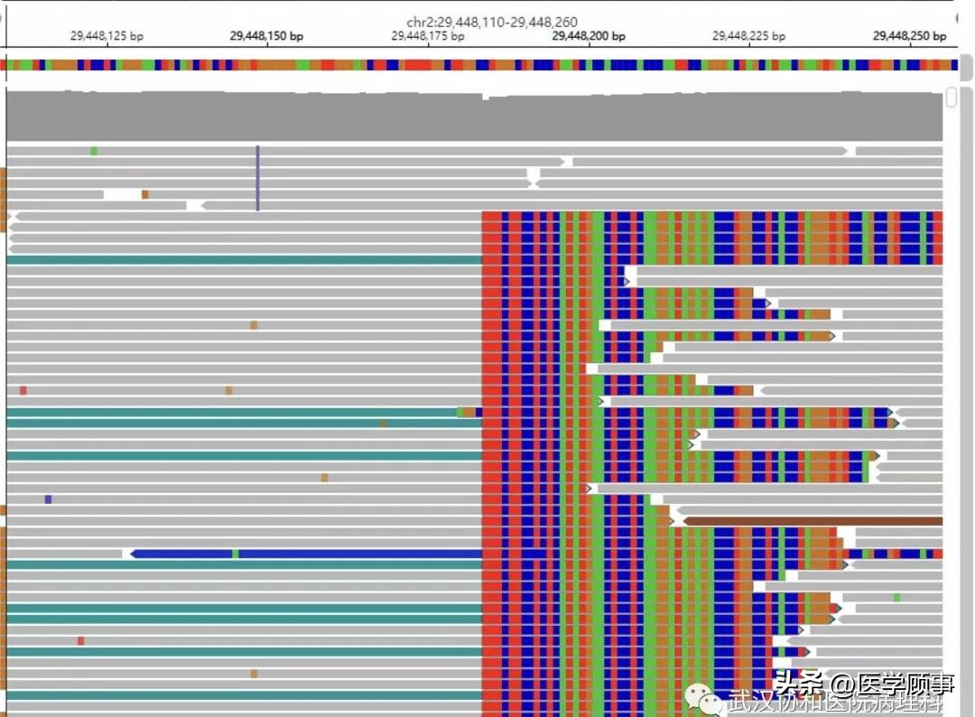 Cytopathological serous cavity effusion cytology specimen - iNEWS