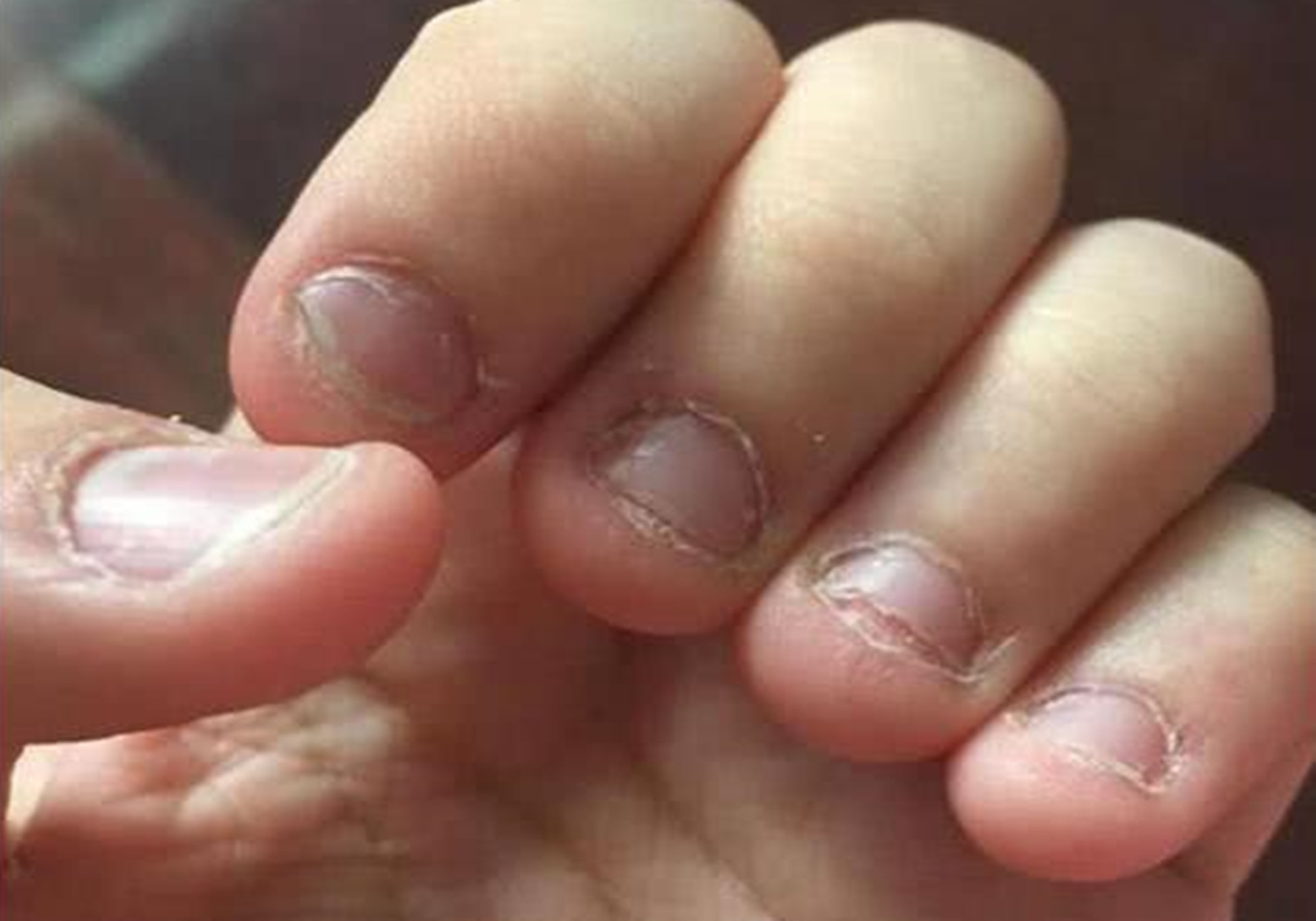 The child always likes to bite things? "Bit your nails" and "bit your ...