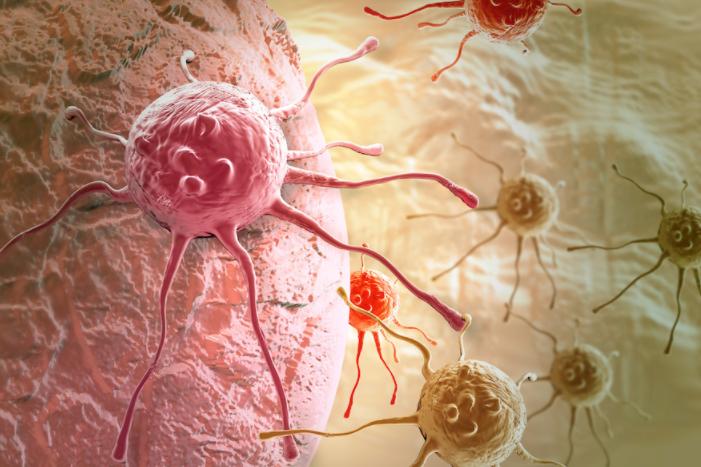 "Starve" cancer cells, true or false?Doctors tell the truth, early ...