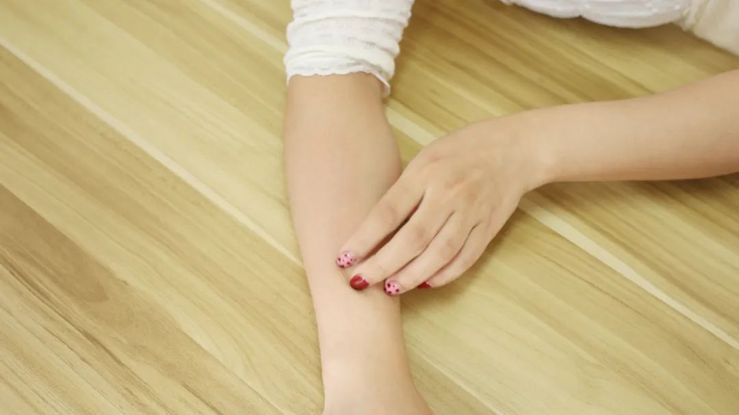 "Itchy, like ten thousand ants bites", what should I do about urticaria ...