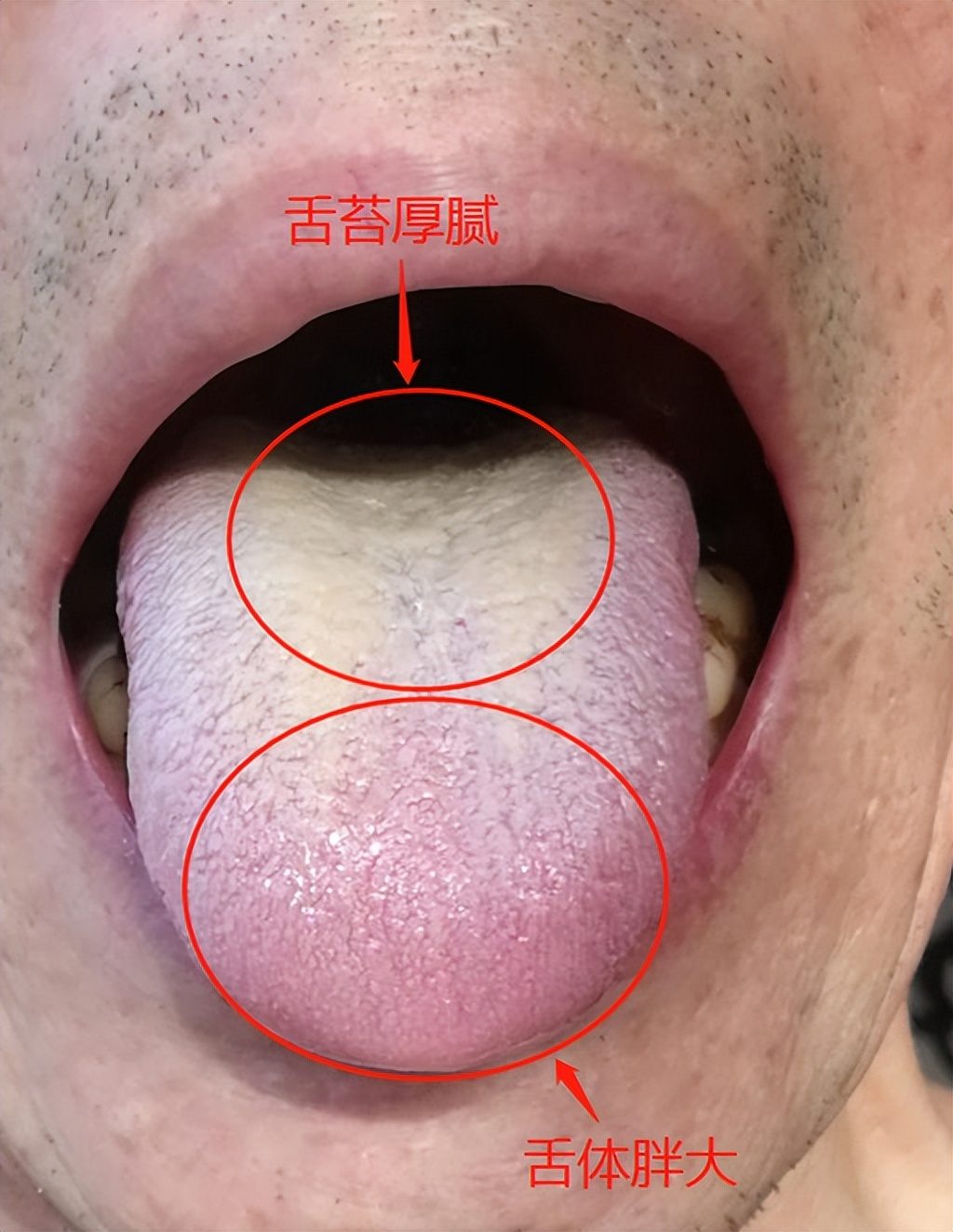 Analysis of fans' tongue images: spleen deficiency, what to do with ...