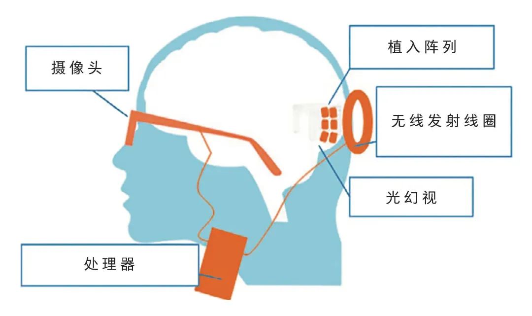 Brain-computer interface and visual prosthesis - iMedia