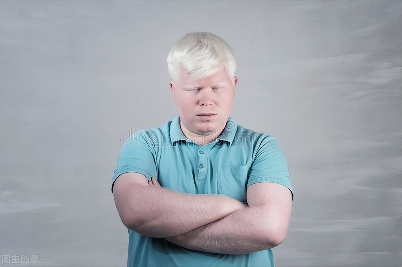 What are the dangers of albinism? - iNEWS